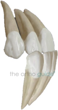 Class III – the ortho guide